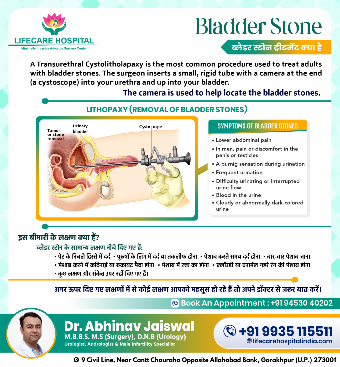 Bladder Stone – Dr. Abhinav Jaiswal Blog
